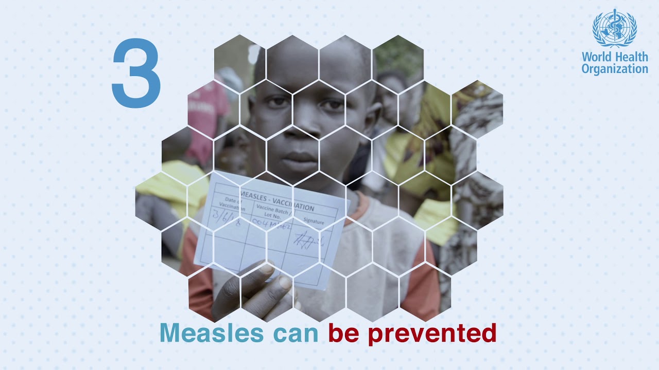 Five things to know about measles