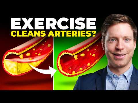 This Exercise Clears Plaque in Your Arteries! New Trial
