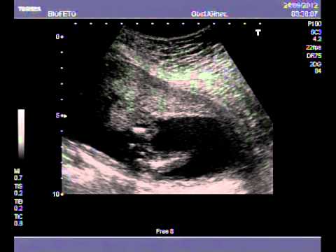 Steam Community :: Video :: Primeiro Vídeo de Clarice