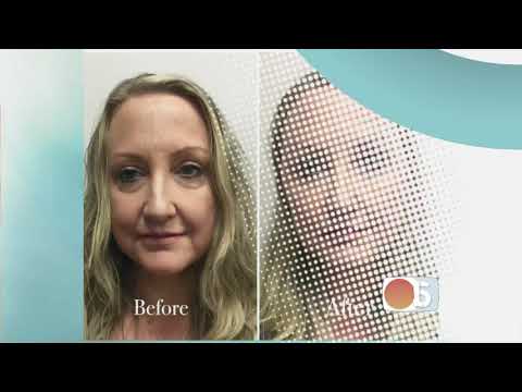 Arcadia Wellness Center shows us how you can update your look in time for the holidays!