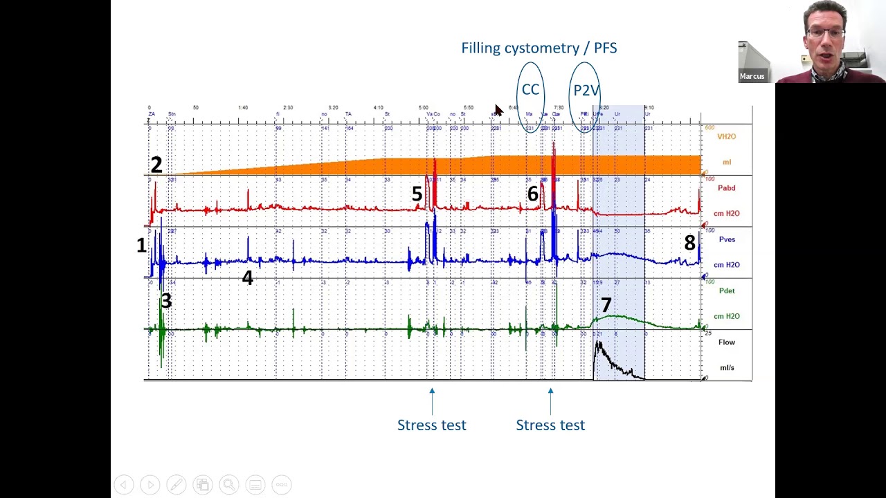 ICS 2020: W26 Basic Urodynamics - An Interactive Workshop