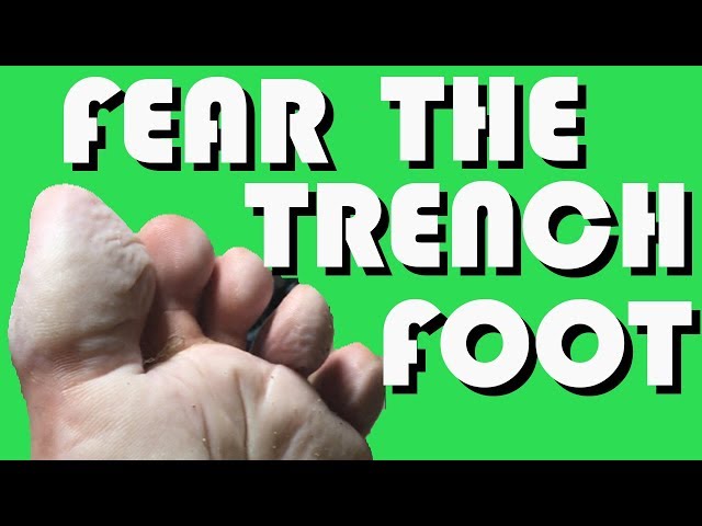 What is Trench Foot? Symptoms explored as hilarious Burning Man memes ...