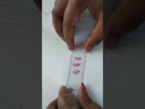 DPX Mount || Histopathology || #mounting