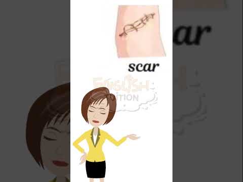 Injuries in English - English Vocabulary - Injury Vocab - Enhance your English Vocabulary