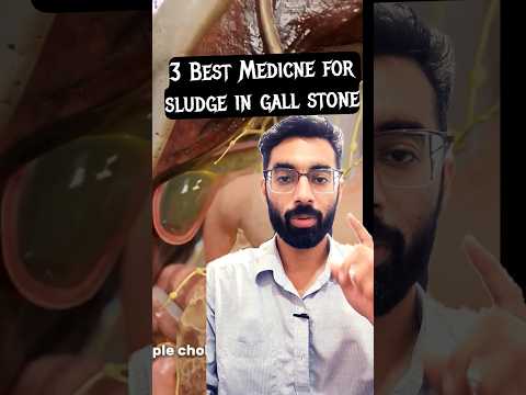 Sludge in gall baldder #gallstones #sludge #gallbladder