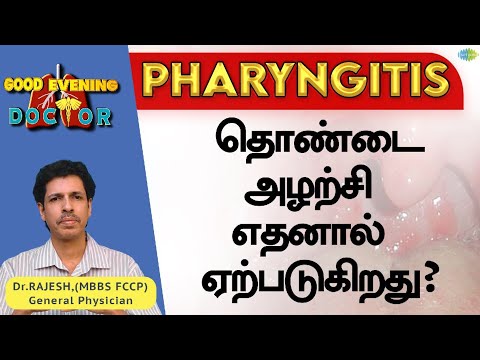தொண்டை அழற்சி எதனால் ஏற்படுகிறது? | EP 180 | Good Evening Doctor