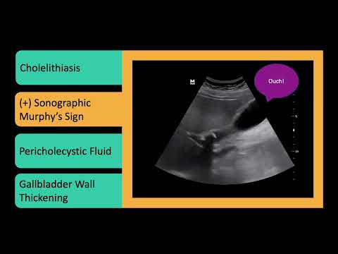 Gallbladder & Biliary POCUS | Scan for Stones, Cholecystitis & Duct Dilation