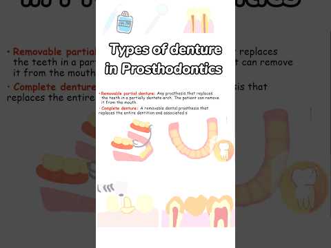 Types of denture #introduction#prosthodontics #denture#dr #dentistry #dentalcrown#dds#mds#bds#neet