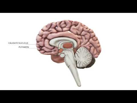 Huntington’sDisease AMT-130 Clinical Trial