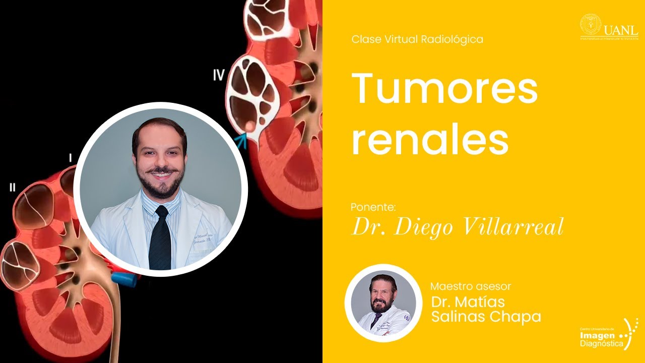 Tumores renales por el Dr. Diego Villarreal Navarro