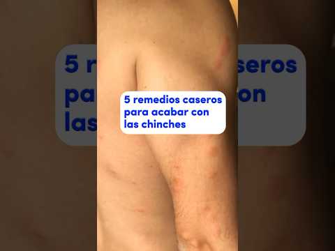 Remedios caseros para acabar con las chinches | #attv #chinches #chinchesmexico #remedioscaseros