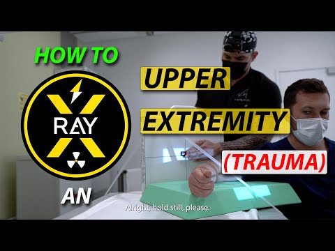 HOW TO X-RAY an UPPER EXTREMITY TRAUMA | radiology program | humerus | elbow | forearm | positioning