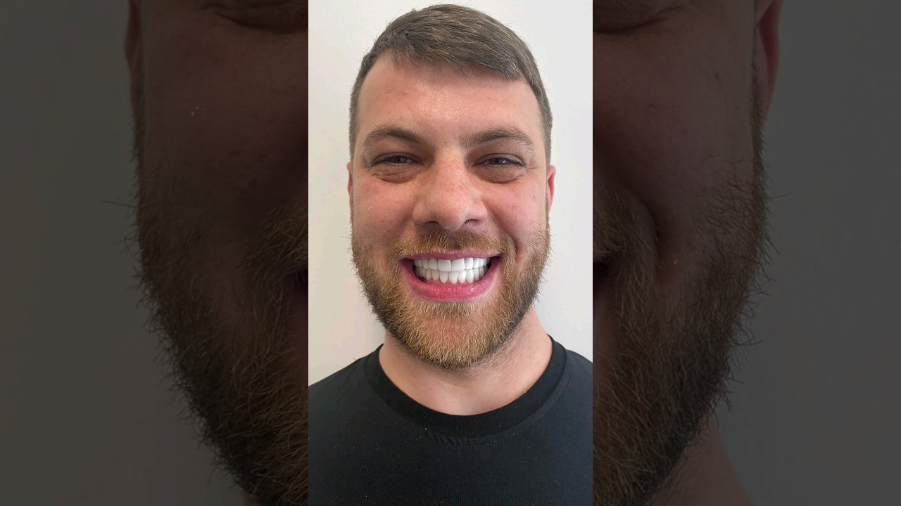 Unveiling Andrei's Radiant Smile with Medlife Group #zirconiumcrowns #dentalcare #smilemakeover