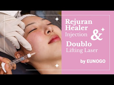 Rejuran Healer Injection and Doublo Lifting Laser | How It's Like | Before & After | Eunogo Beauty