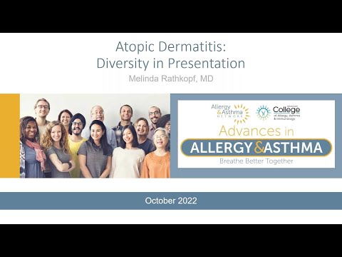 Atopic Dermatitis Diversity in Presentation