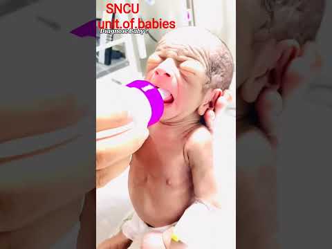 Little hungry angel ๐๐๐๐๐ถ๐ถ๐ถ๐ฅฐ๐ฅฐ๐ผ๐ผ #premature #newbornbaby #medical