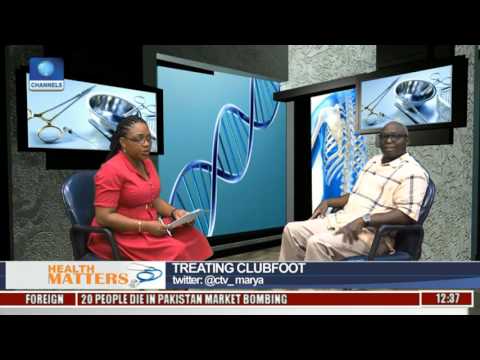 Health Matters: Focus On Treating Clubfoot Pt. 1