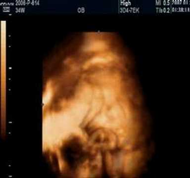 Real-time baby