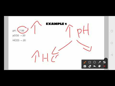 Practical medicine: Interpretation of ABG(Arterial Blood Gas Analysis)