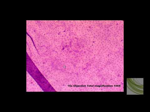 SLIDE: Simple Squamous Epithelia
