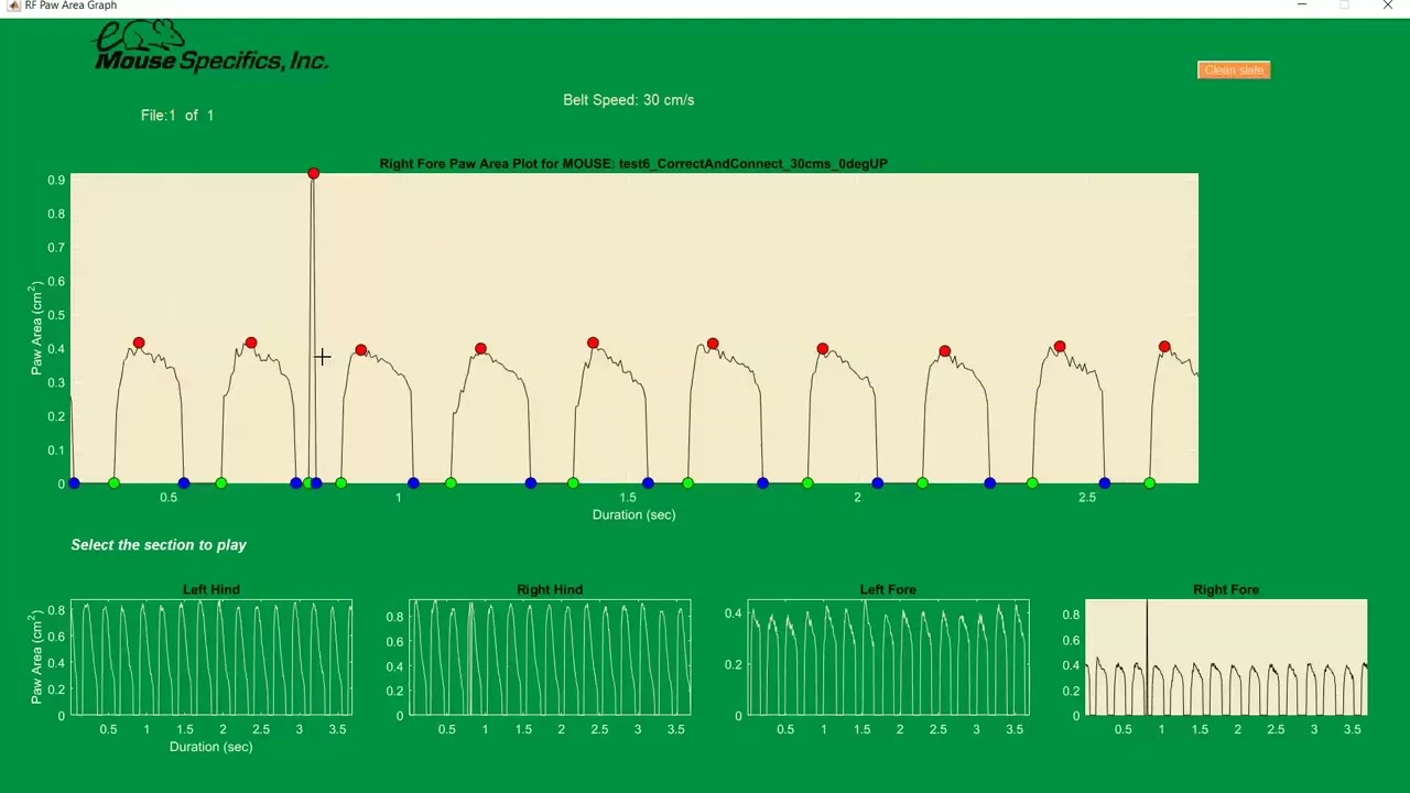DigiGait Analysis: Postprocessing