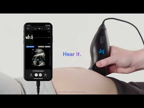 Butterfly It: OB/GYN Ultrasound