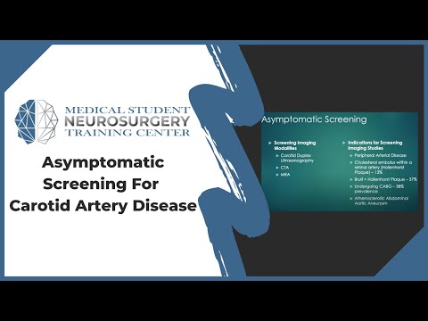 Asymptomatic Screening For Carotid Artery Disease