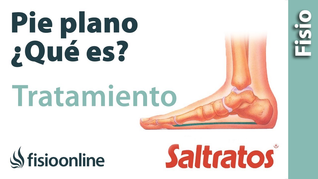 Flatfoot or Dropped Foot - What It Is, Causes, Symptoms, and Treatment