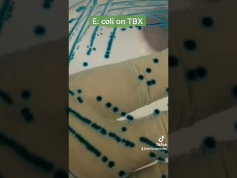 E. coli on TBX Agar #Elmicrobiologist #microbiology #medicalmicrobiology #foodmicrobiology