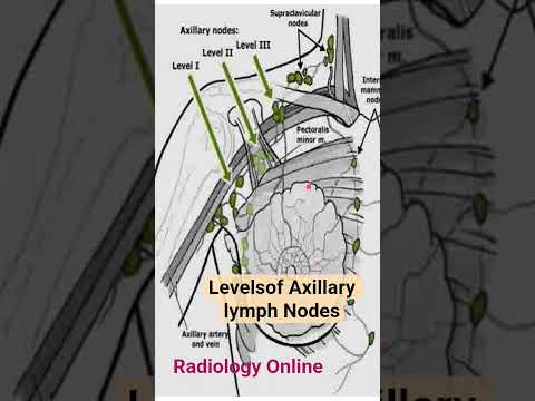 Radiology Online- axillary lymph nodes levels. Like,share and subscribe. #anatomy