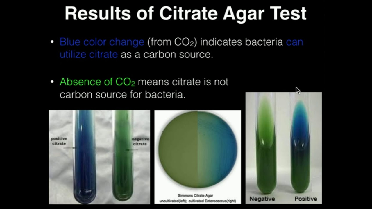 Microbiology: Citrate Agar