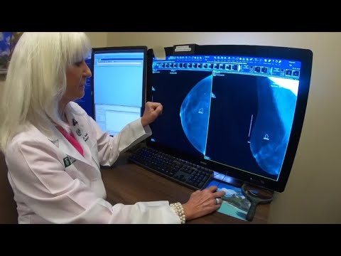 New technology at Boca Raton Regional Hospital helps find breast cancer earlier