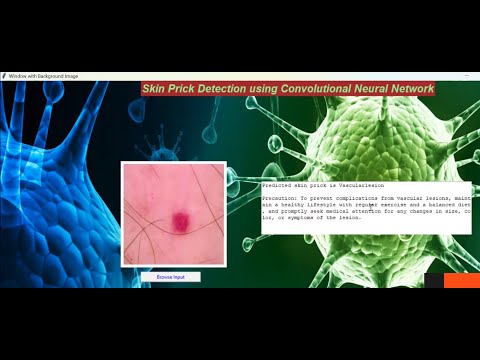 Skin Prick Test Wheal Detection Using CNN
