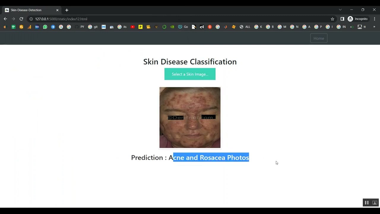 CI Net Clinical Inspired Network for Automated Skin Lesion Recognition ...