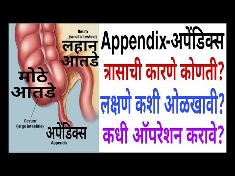 Appendix -अपेंडिक्स त्रासाची कारणे कोणती? लक्षणे कशी ओळखावी?कधी ऑपरेशन करावे?/115/@drramjawale