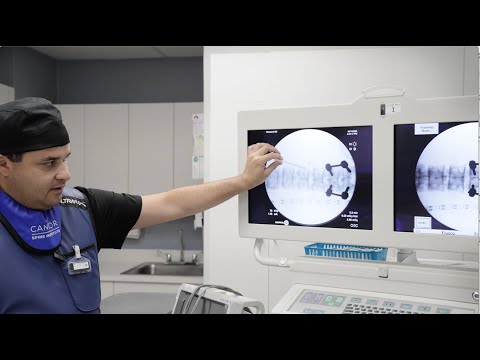 Transforaminal Injection with Dr. Giuffrida | Cantor Spine Center
