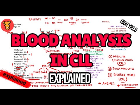 Chronic Lymphocytic Leukemia (CLL) Blood Analysis EXPLAINED: Diagnostic Algorithm (Beginner’s Guide)