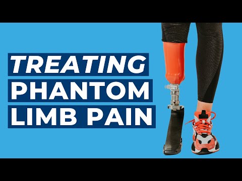 What is Targeted Muscle Reinnervation? | Treating Phantom Limb Pain
