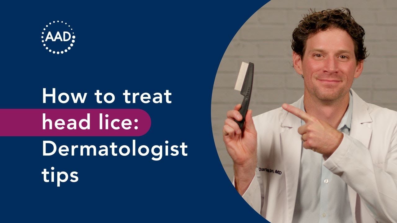 How to treat head lice: Dermatologist tips