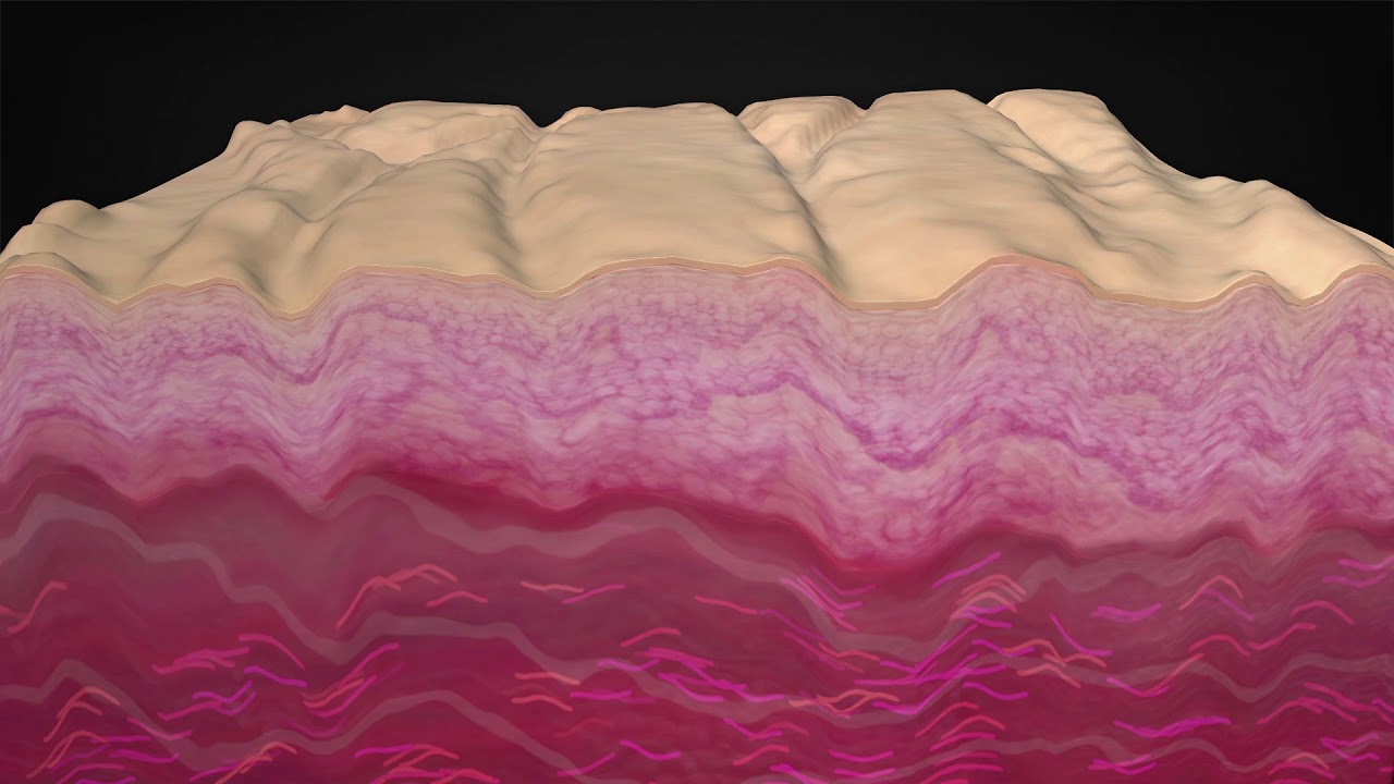 How does PicoSure work for Focus Pigment ?
