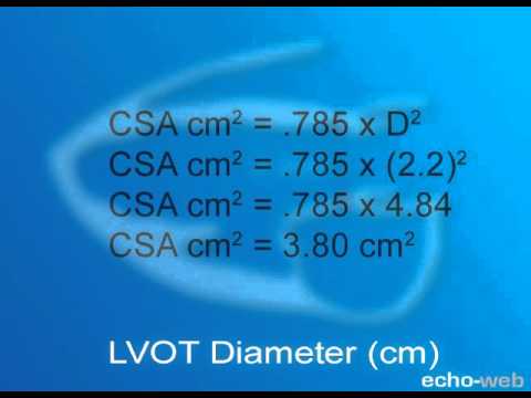Echo-Web "How To" Series - Calculating Stroke Volume