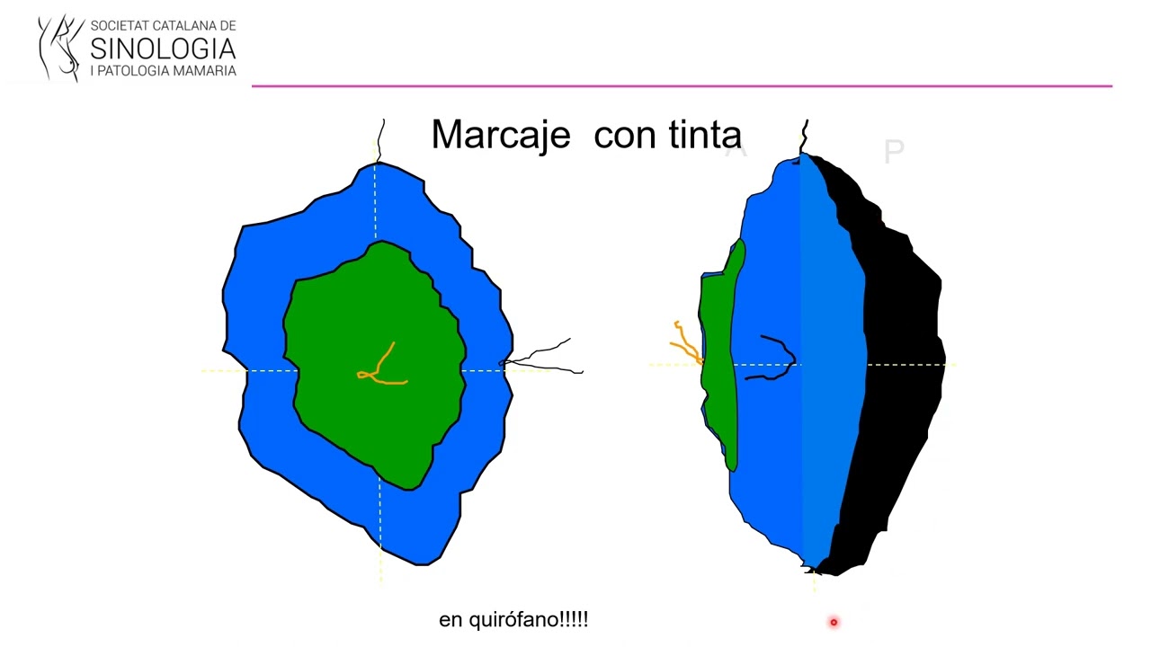 Módulo 3: Diagnostico anatomopatologico