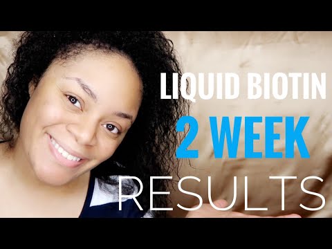 Liquid Biotin 2 Week Update | 10,000 MCG