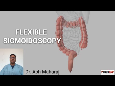 Flexible Sigmoidoscopy