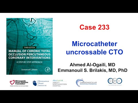 Case 233: Microcatheter uncrossable CTO