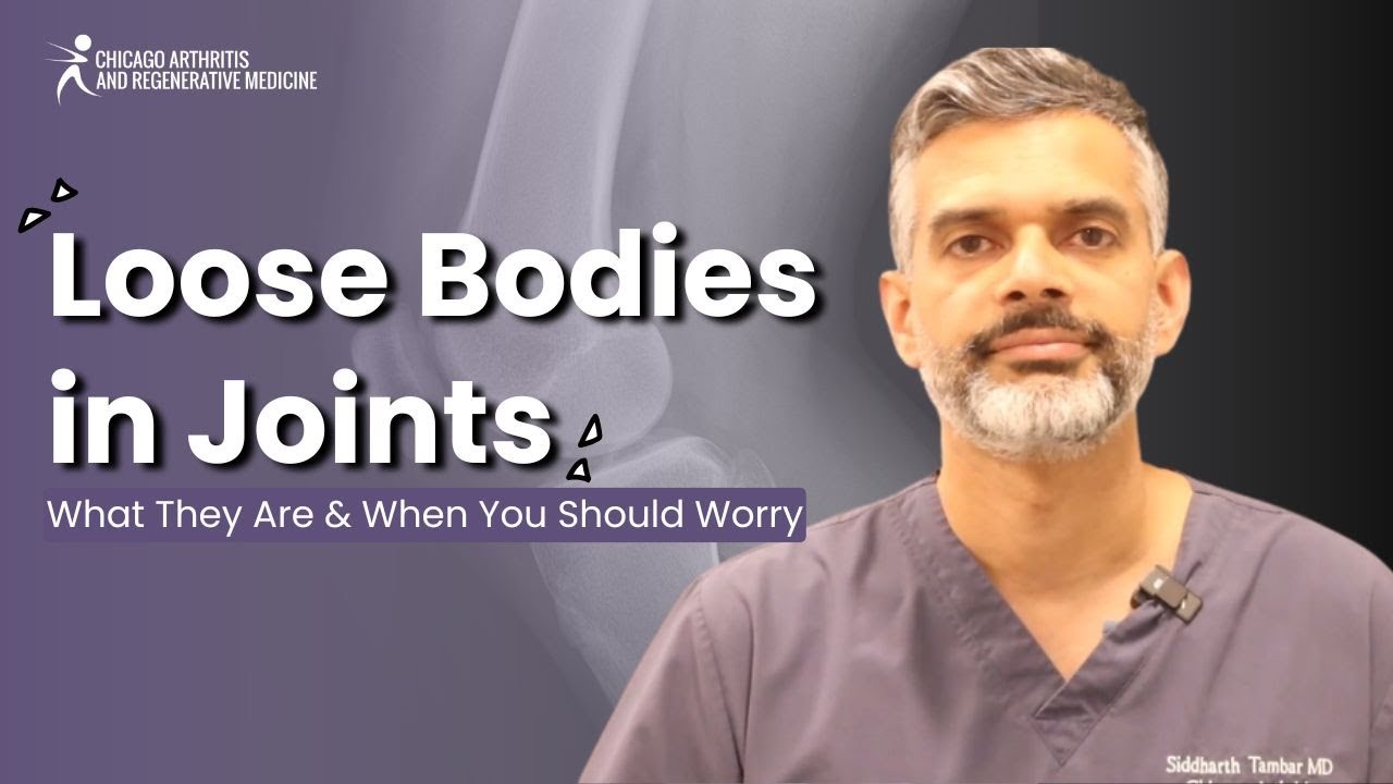 Loose Bodies in Joints: What They Are & When You Should Worry - Chicago ...