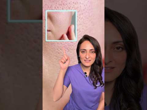 Open pores | how to treat | what to do & what to avoid
