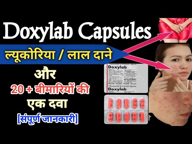 Antibiotics Medicines - Doxylab Doxycycline 100 Mg Tablets Trader ...