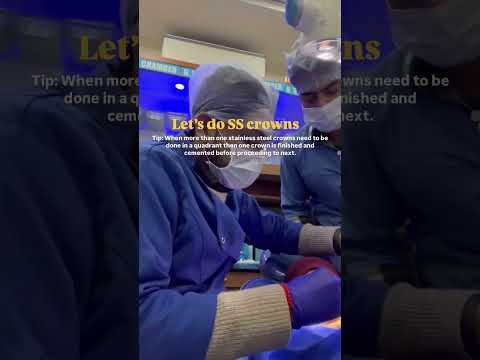 STAINLESS STEEL CROWN HACK!