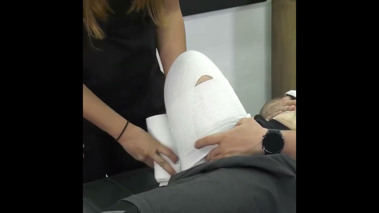 Management of the amputee patient: Stump bandaging